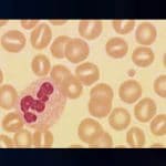 Normocitosis y normocromía. Significados y características